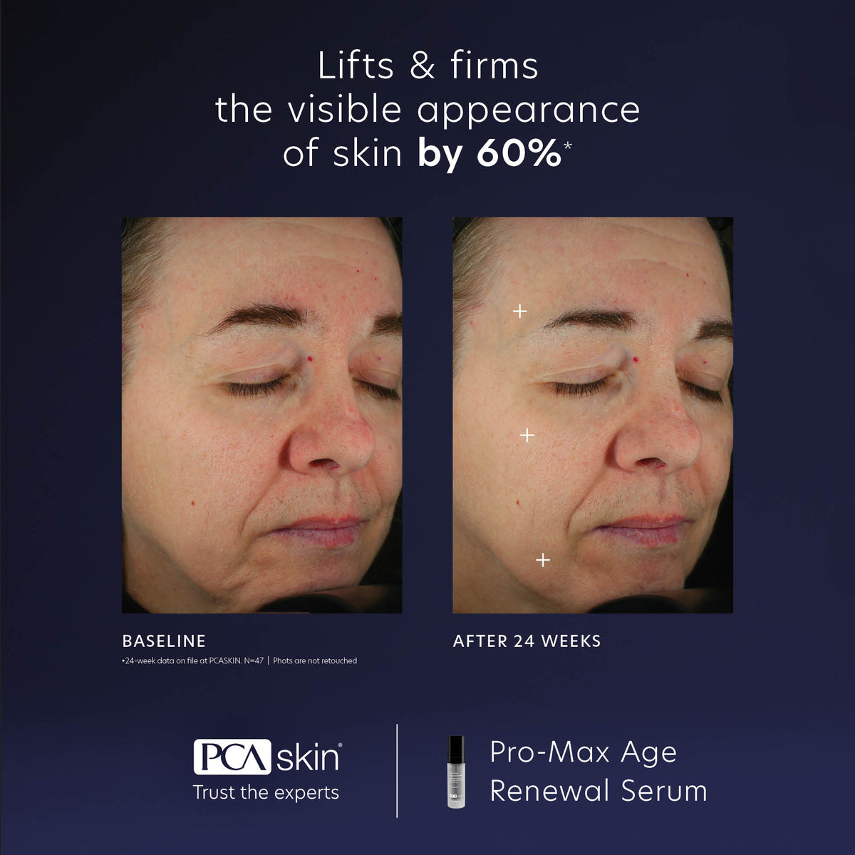 PCA Pro-Max age Renewal | Advanced serum with growth factor technology